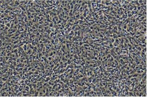 抗ウイルス性・繊維製品（JIS L 1922・ISO 18184） | 一般財団法人カケンテストセンター