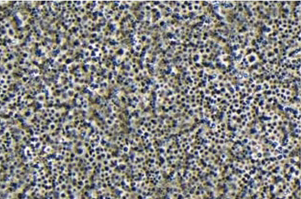 抗ウイルス性・繊維製品（JIS L 1922・ISO 18184） | 一般財団法人カケンテストセンター
